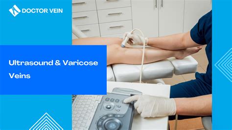 Ultrasound Varicose Veins Doctor Vein