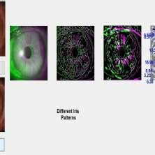 PDF Matching Of Iris Pattern Using Image Processing