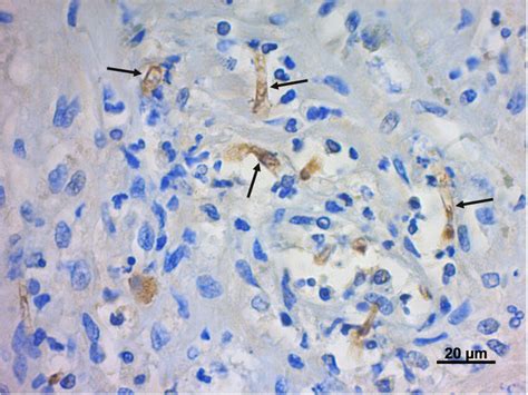 Micrograph Of Intestine Infected With Pythium Insidiosum Septate Micrograph Of Intestine Infected With Pythium Insidiosum Septate
