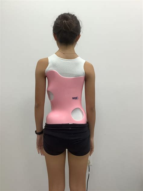 Spinal Orthoses Ortho Dynamics Inc