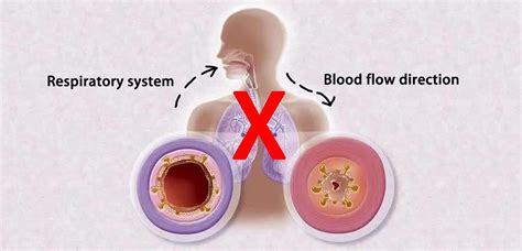 What Are Hypoxia And Hypoxemia What Is Hypoxia？ By Kevinlwm Professional Medical Device