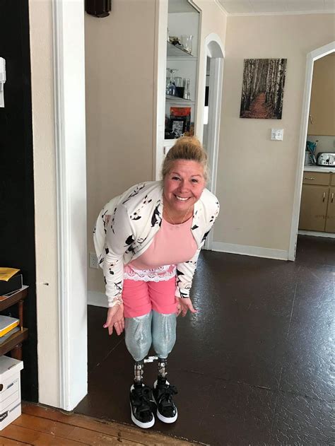 Socket Socks Prosthetic Covers Artofit