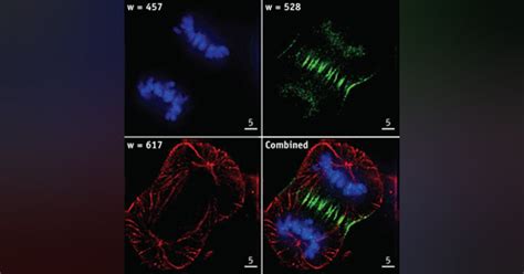 Complex Monolithic Optics Enrich Fluorescence Imaging Laser Focus World