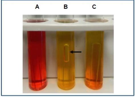 Micro Lab 3 Diagram Quizlet