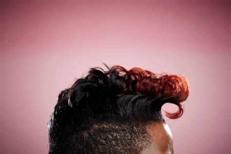 Eczema On Your Scalp Heres How To Ease Symptoms Fast Essence