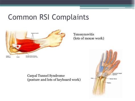 Addressing Rsi Through Inclusive Design