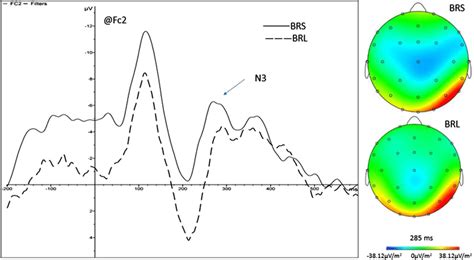 ERP Waveforms And Corresponding EEG Activation Patterns At The Fc2 Site Download Scientific