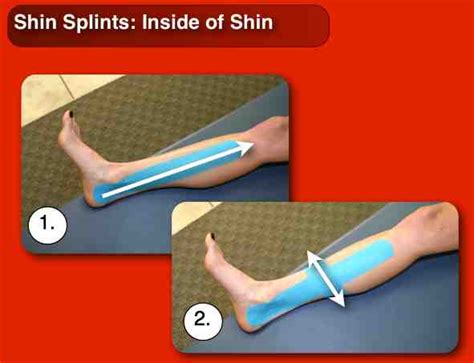 How To Get Rid Of Shin Splints Forever In Simple Steps