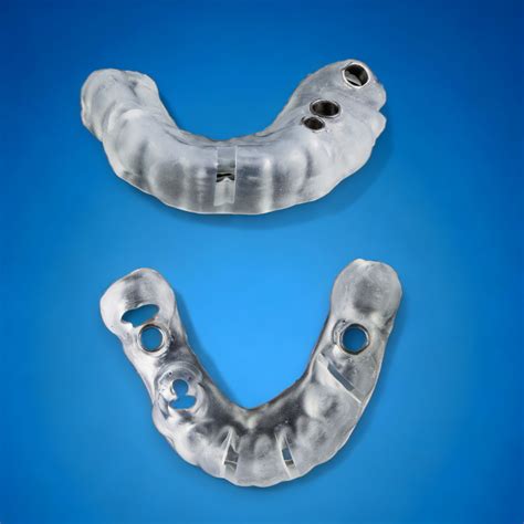 Precision Surgical Guides Summit Horizon Dental Lab