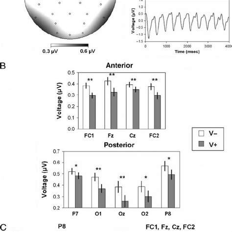 Effects Of Visual Perceptual Load On Irrelevant Visual Distractor Download Scientific Diagram