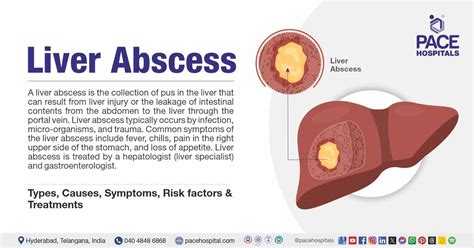 Liver Abscess Causes Symptoms Prevention Treatment
