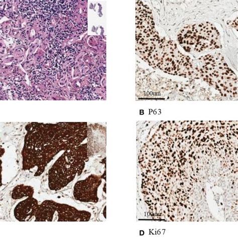Immunohistochemical Staining Of Histopathology A Hematoxylin Eosin Download Scientific