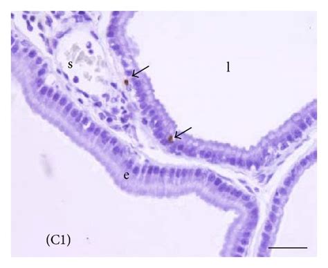Apoptotic Cells Quantified By The Tunel Method Brown Nuclei A Download Scientific Diagram