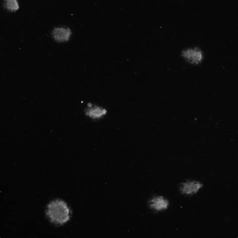 Fuzzy Comets In Comet Assay And Variable Appearance Of Untreated Control Has Anyone Seen This