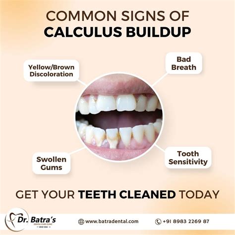 Common Signs Of Calculus Buildup — Keeping Your Smile Healthy At Batra