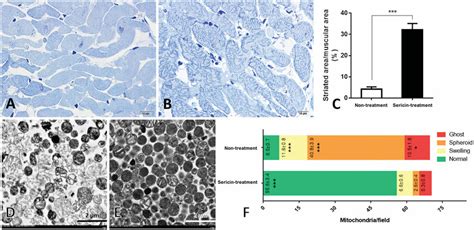Histopathology Of Cardiac Muscle And Ultrastructure Of Heart Download Scientific Diagram