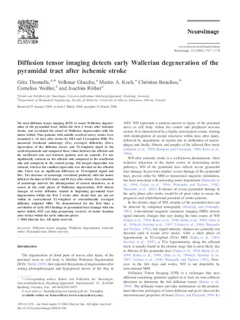 Pdf Diffusion Tensor Imaging Detects Early Wallerian Degeneration Of