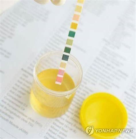 위클리 건강 갑작스러운 소변의 변화건강 이상 신호일까
