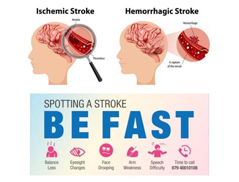 Neurosurgery In Brain Stroke Treatment By Hcg Hospitals