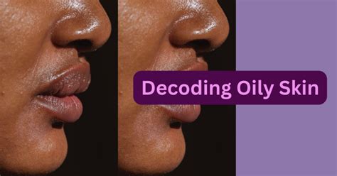Decoding Oily Skin Understanding Causes Care And Confidence