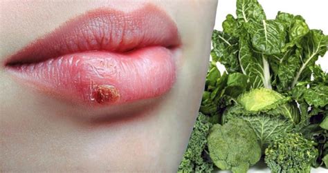 Dangerous Yet Often Neglected Signs Of Folate Deficiency