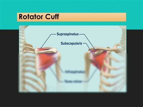 Solution Anatomy Extensor Compartment Of Arm And Musculer Spaces