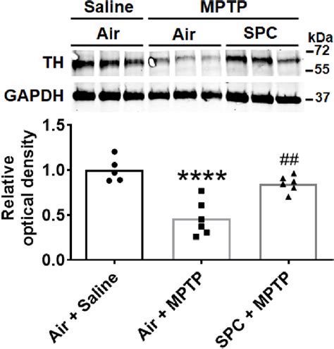 Tyrosine Hydroxylase Levels In The Nigrostriatal Region Representative