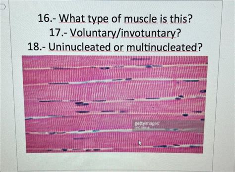 Solved 16 What Type Of Muscle Is This 17