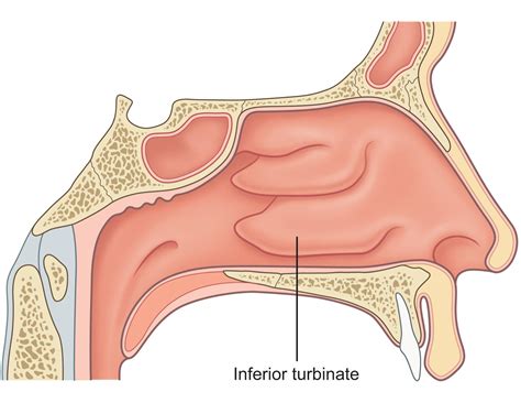 Turbinate Reduction Techniques In Rhinoplasty Clinical Tree Turbinate Reduction Techniques In Rhinoplasty Clinical Tree