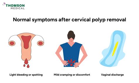 What To Expect After Cervical Polyp Removal And Recovery Tips Thomson Medical