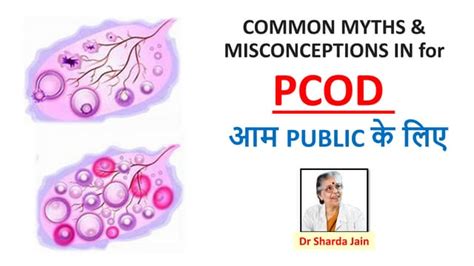 Common Myths And Misconceptions In For Pcod आम Public के लिए Dr Sharda Jain Pptx