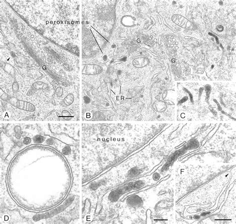 Fine Structure Of Peroxisomes In The Perinuclear Region Of Mutant Ldlf