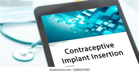 Penile Implantation Medical Procedures Surgical Procedure Stock Photo Shutterstock