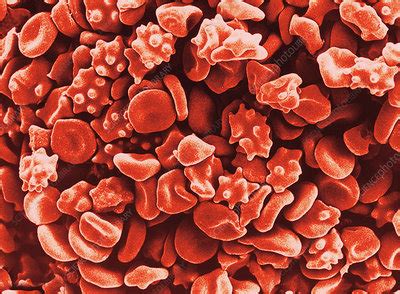 Coloured SEM Of Red Blood Cells Erythrocytes Stock Image P242 0233 Science Photo Library