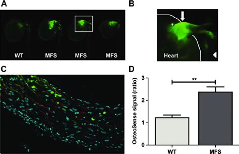 Microcalcification In The Mfs Mouse Ascending Aorta A Download