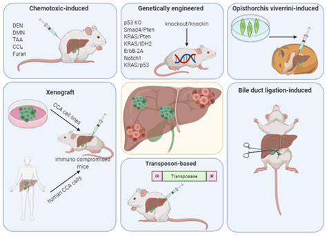 Cholangiocarcinoma Diagram