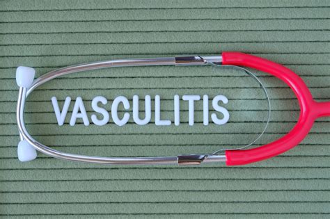 Vasculitis Healthy Life