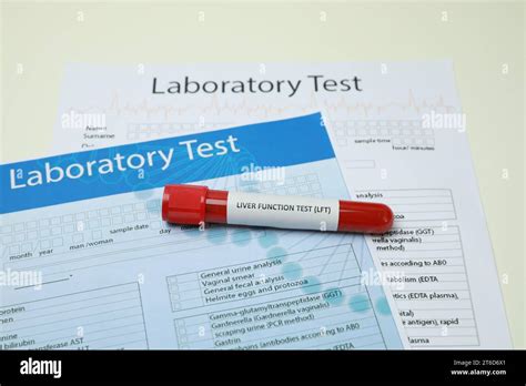 Labcorp Liver Function Test Tube At Kevin Tejeda Blog