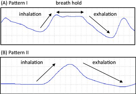 Respiratory Patterns Download Scientific Diagram