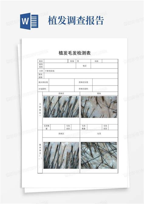 头发检测报告word模板下载 编号qkwndkoz 熊猫办公
