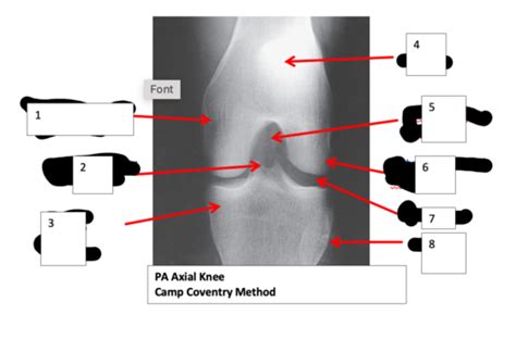 Pa Axial Knee Camp Coventry Method Flashcards Quizlet