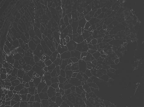 Challenging Issue With Cell Area Measurement And Identification R