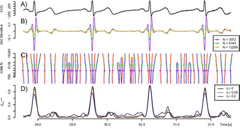 Figure 1 From Removal Of Ecg Artifacts From Emg Signals With Different Artifact Magnitudes By