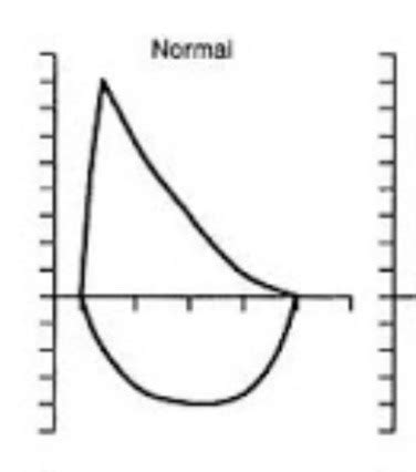 Pft Final Flashcards Quizlet