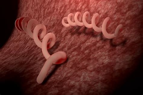 記者 梅花新聞網 於慶中綜合報導 史上次高！日本上半年6722人染梅毒 東京病例最多 ｜ 梅花新聞網