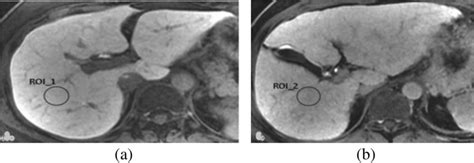 Experimental Setup Of Ingestible Iot Sensor With Activity Tracker Download Scientific Diagram