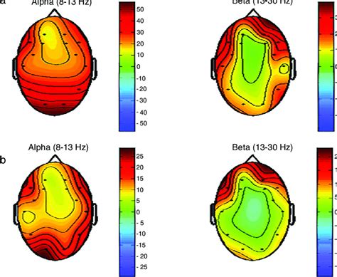 Brain Activations Characterized By The Alpha And Beta Rhythms Of The Download Scientific