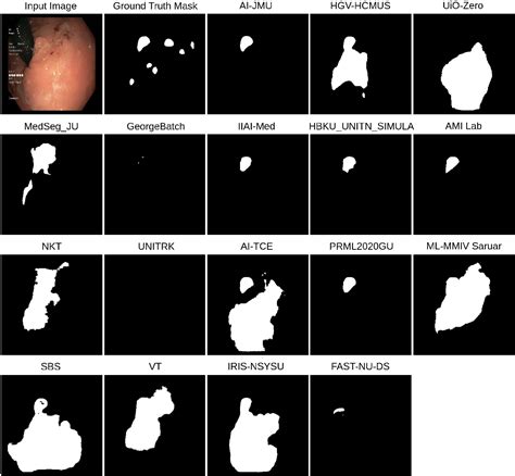 Figure 6 From An Objective Validation Of Polyp And Instrument