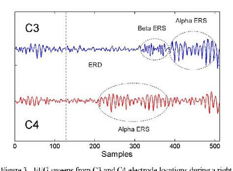Figure 1 From Using Multiresolution Space Time Frequency Features For The Classification Motor
