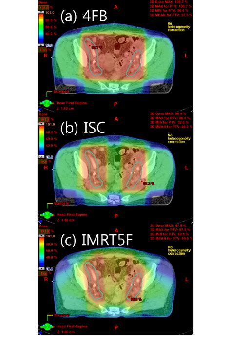 Isodose Curves For The Four Field Box 4fb A Irregular Surface Download Scientific Diagram